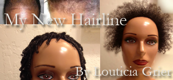 My New Hairline | A Diva's Hidden Hair Manufacturer